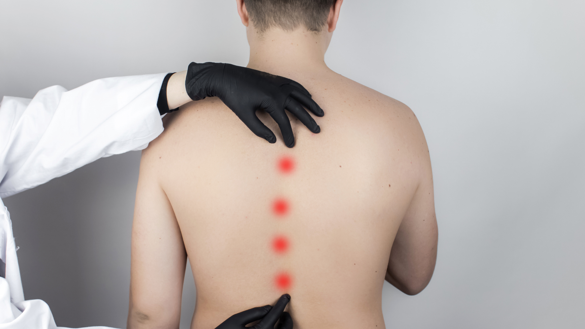 Common Spinal Deformities | Spine Team Texas