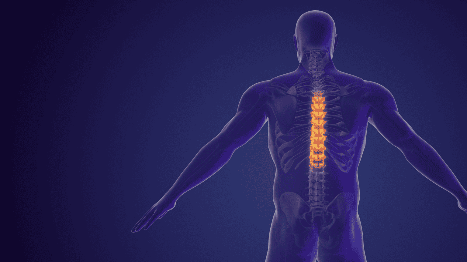 Spinal Cord Stimulation: How it Works | Spine Team Texas