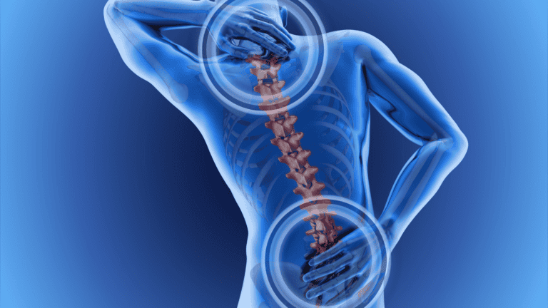 How to Treat Chronic Back Pain Without Surgery | Spine Team Texas